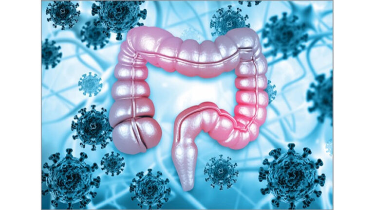 Bowel Prep’s Importance, Cold EMR Drawbacks and AI-Stratified Bleeding ...