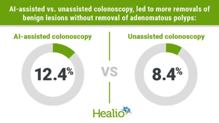 AI-assisted colonoscopy boosts polyp removal, but ‘only benign, non ...