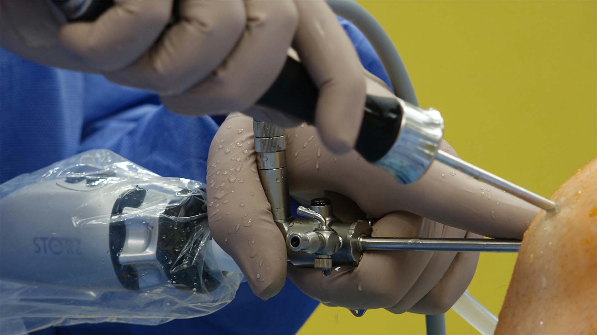 Why Office-Based Endoscopy Is Gaining Ground—and Why It Matters ...