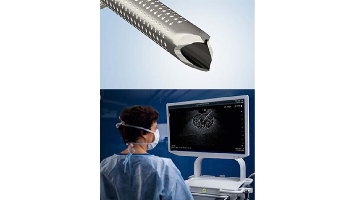 Olympus Announces U.S. Launch of the SecureFlex™ Single-Use Fine Needle ...