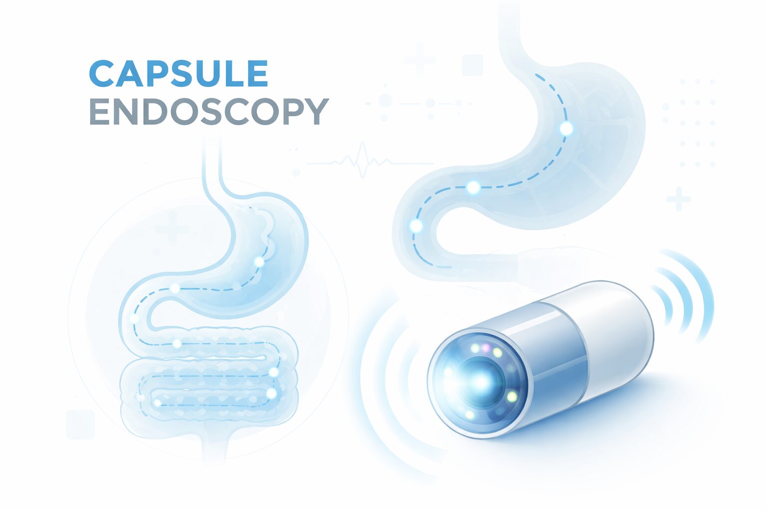 Capsule Endoscopy (GI & Endoscopy News) - Scope Forward